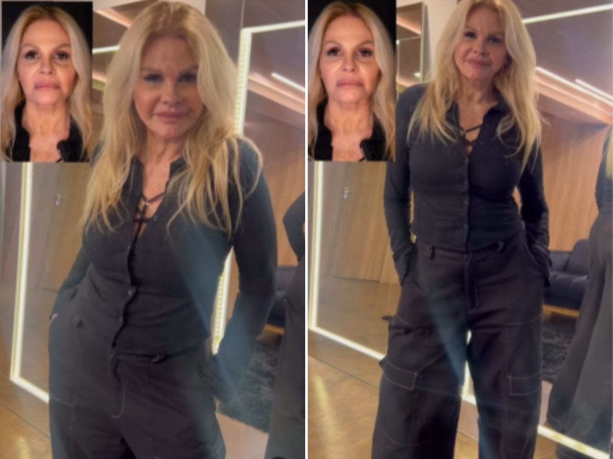 Monique Evans passa por mais um procedimento no rosto para casamento ...