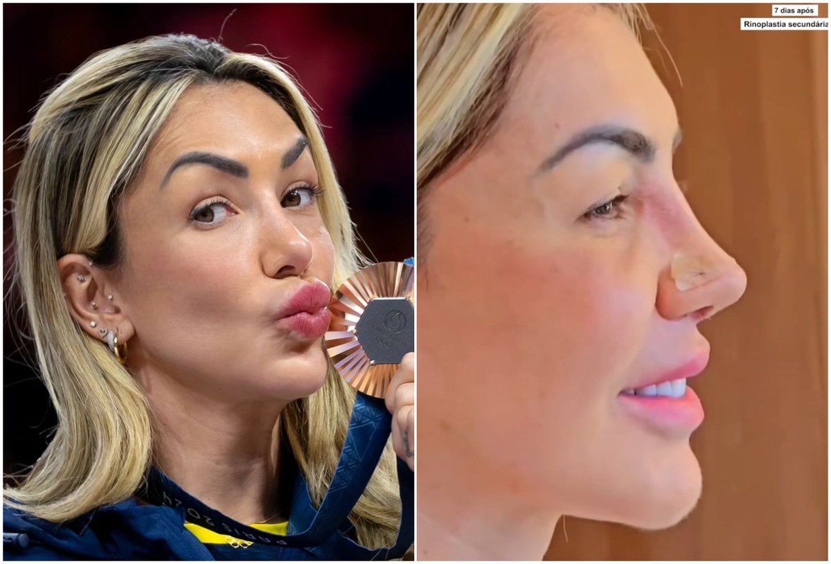 Thaisa Daher exibe resultado da segunda rinoplastia: 'Mais delicadinho'