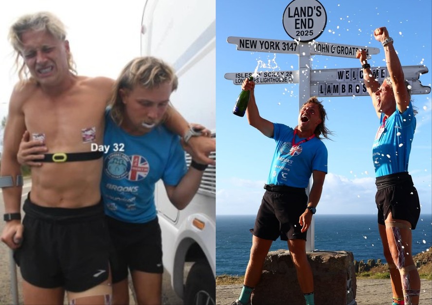 Superando risco de amputação após infecção generalizada, irmãos ...