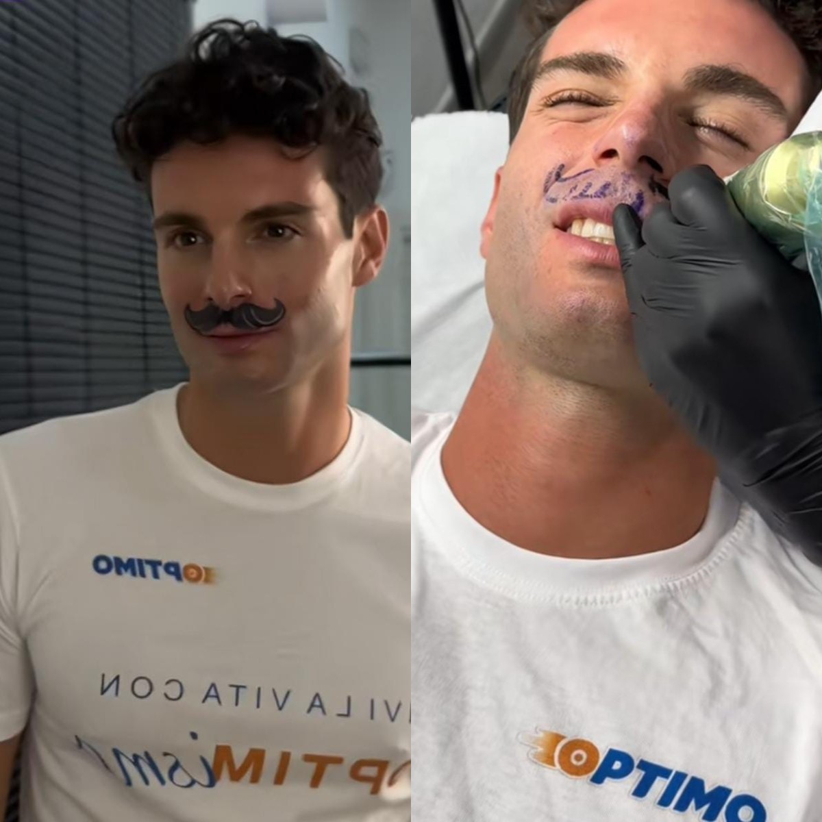 Homem tatua bigode cartoon no rosto e viraliza; vídeo