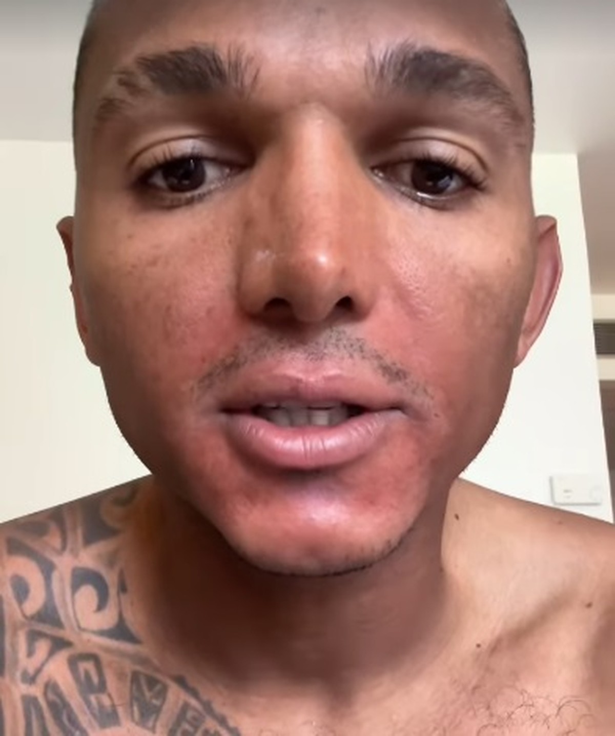 Isaquias Queiroz mostra machucado no rosto, resultado de treinamentos ...