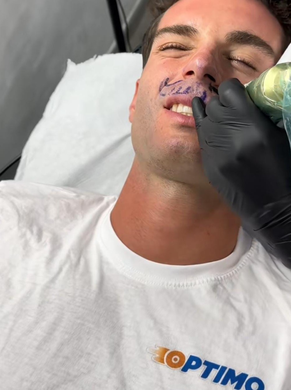 Homem tatua bigode cartoon no rosto e viraliza; vídeo